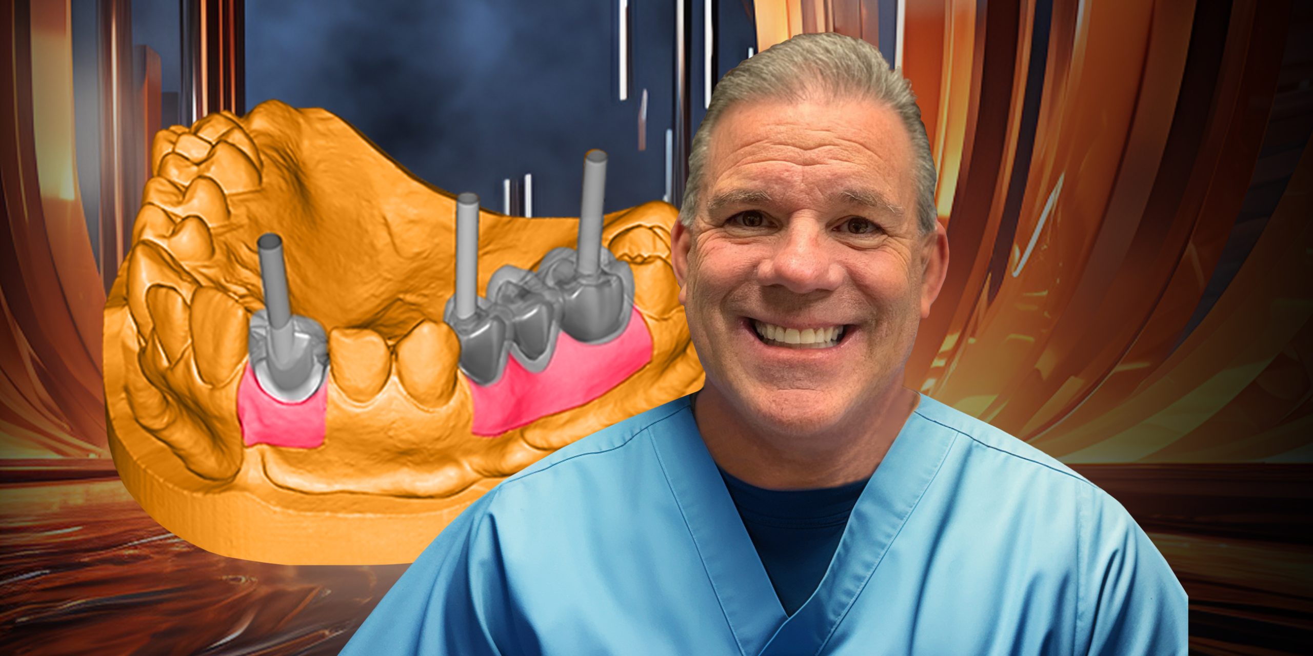 👉EXOCAD Implant Restorations: Step-by-step Video Guide - BKMED EVENTS
